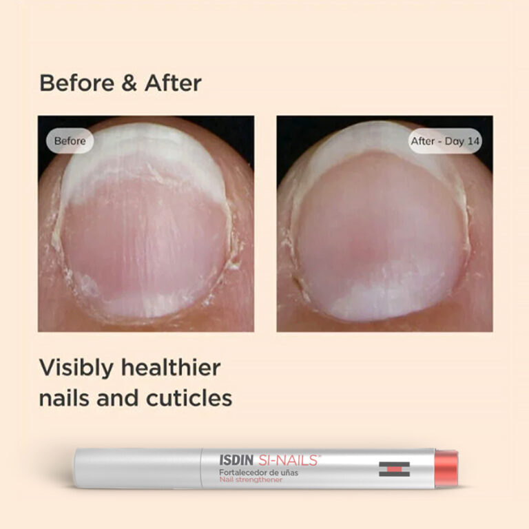 ISDIN Si-Nails Nail-strengthening treatment, 2.5 ml - Palsons Derma